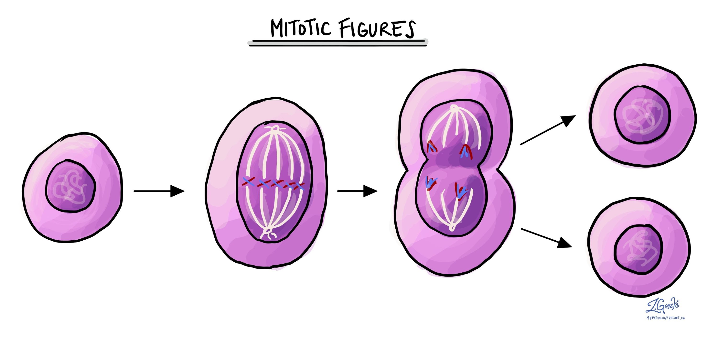 Mitotic Figure Pathology Dictionary MyPathologyReport ca Mitotic Figure Pathology Dictionary MyPathologyReport ca