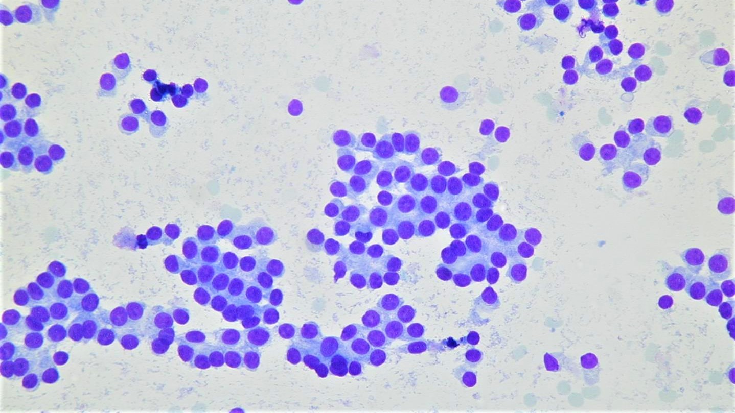 Thyroid Follicle Em Thyroid Follicle Em