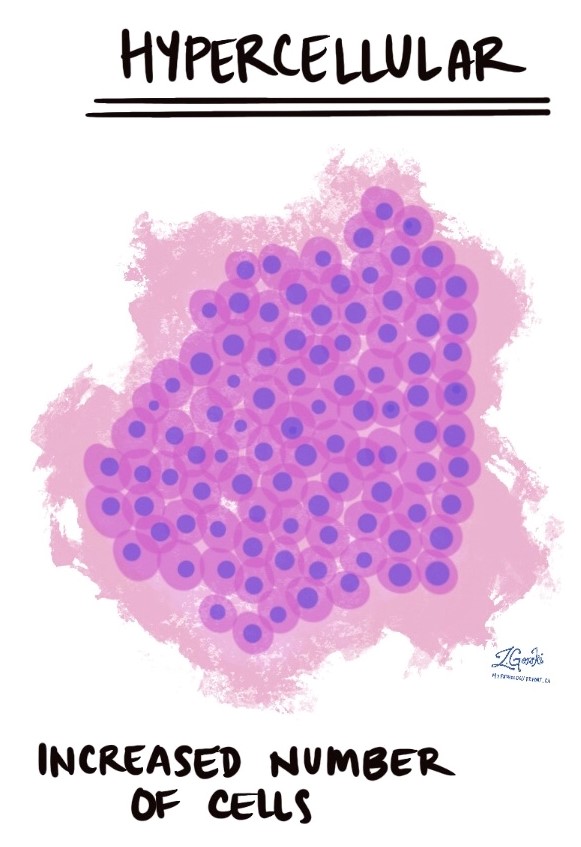 What is hypercellular? | MyPathologyReport