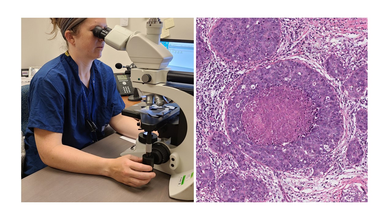 How to read your pathology report | MyPathologyReport.ca