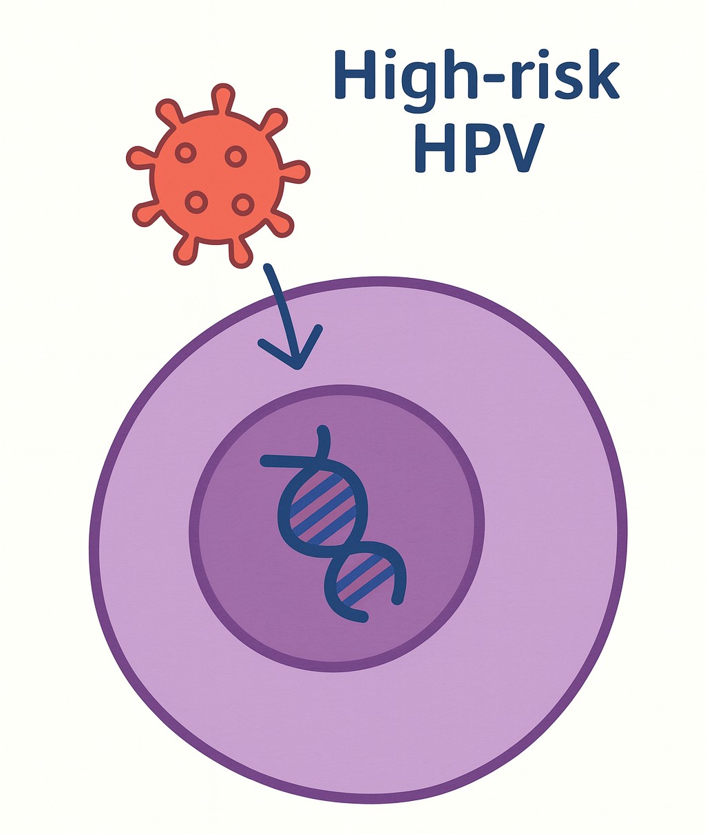 High risk HPV | MyPathologyReport